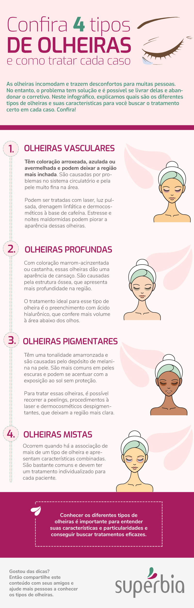 Confira 4 tipos de olheiras e como tratar cada caso